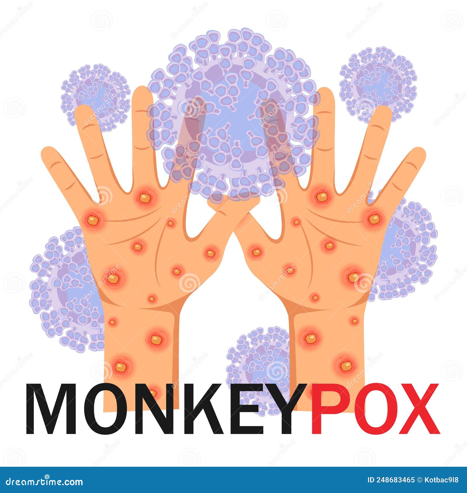 Virus In Human Body. Parasites And Nerves. Allergy And Allergic ...