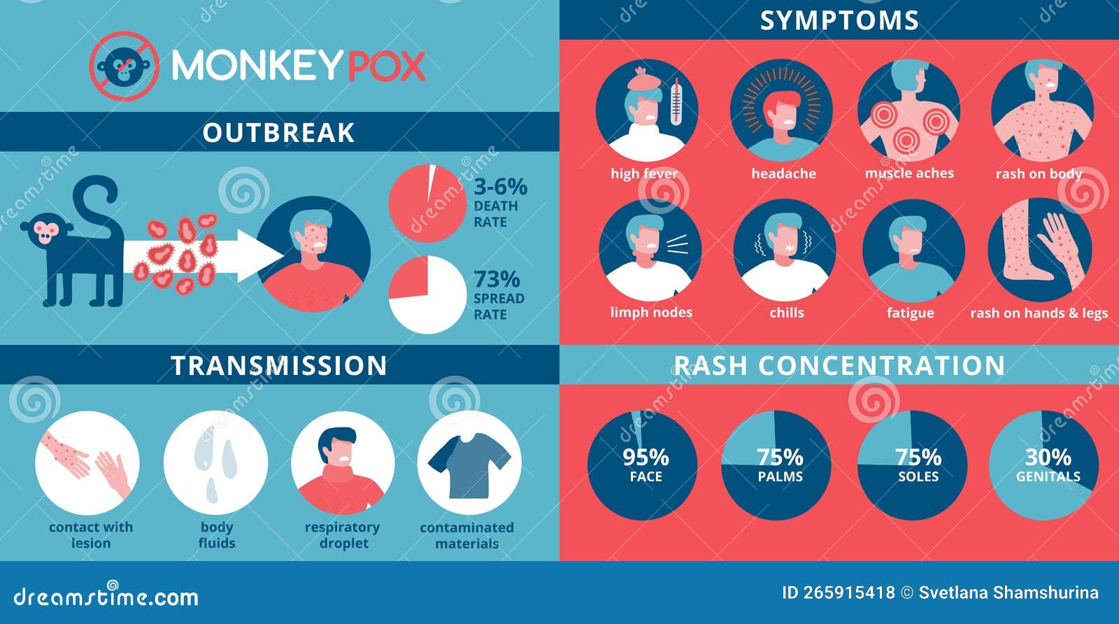 Symptoms Of The Monkey Pox Virus. Monkey Pox Is Spreading. This Causes ...