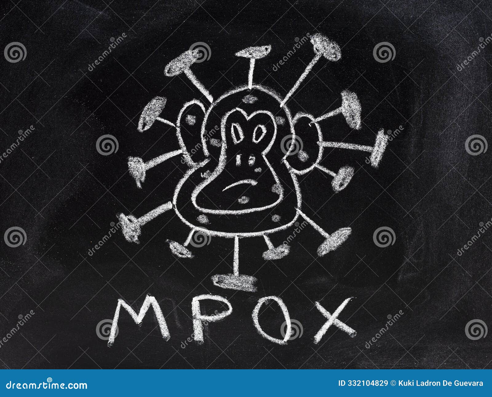 Monkeypox Virus, Mpox, Hand Drawn on a Blackboard Stock Image - Image ...