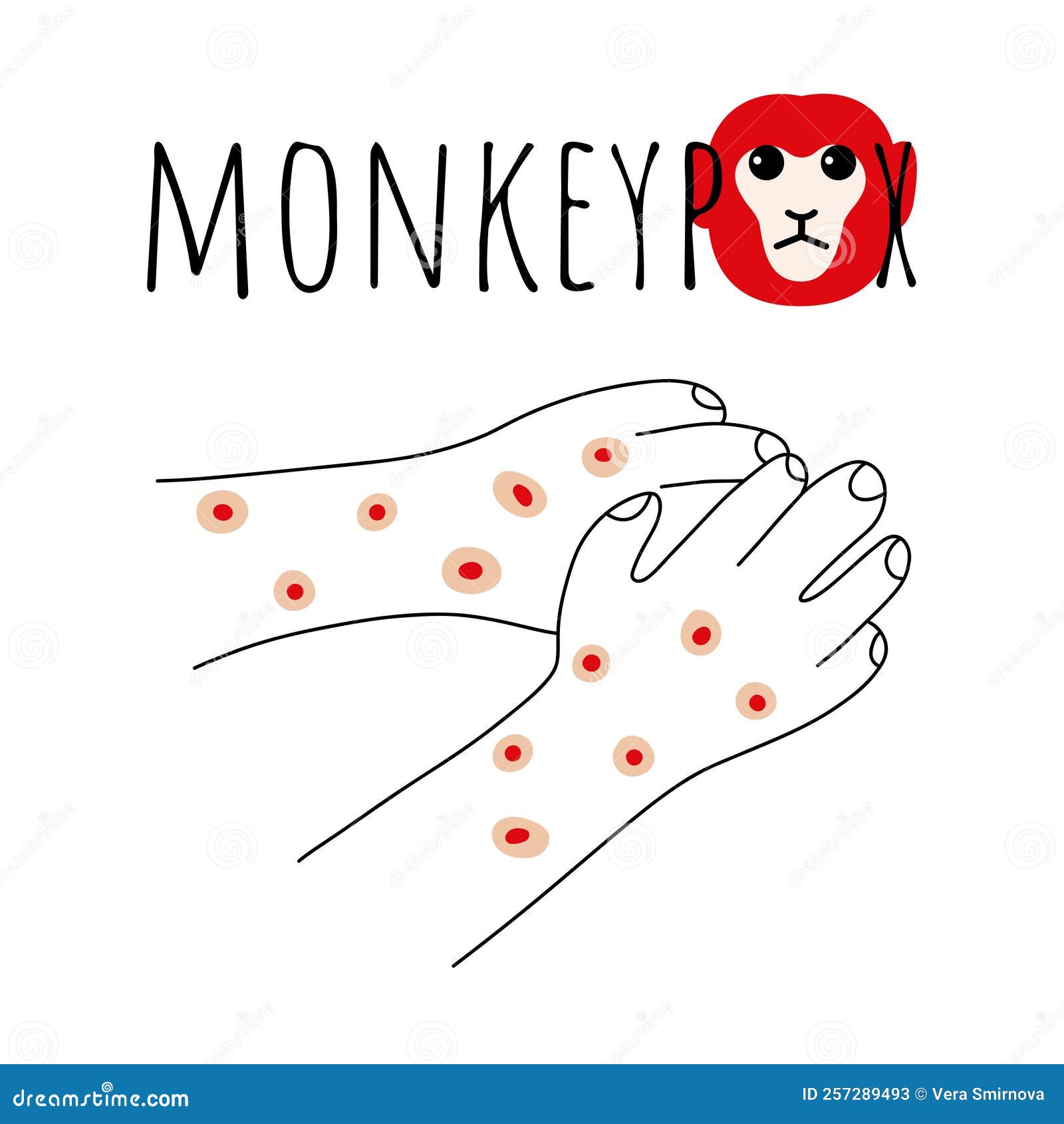 Smallpox Disease Cell Vector Cartoon | CartoonDealer.com #187804222