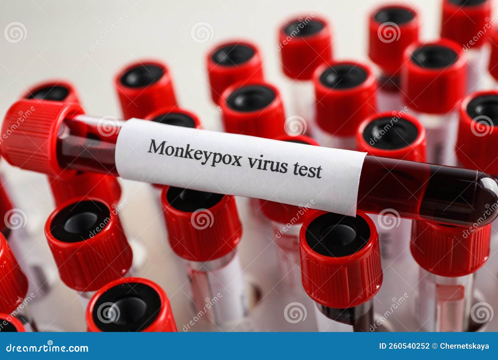Monkeypox Virus Test. One Sample Tube with Blood on Others, Closeup ...