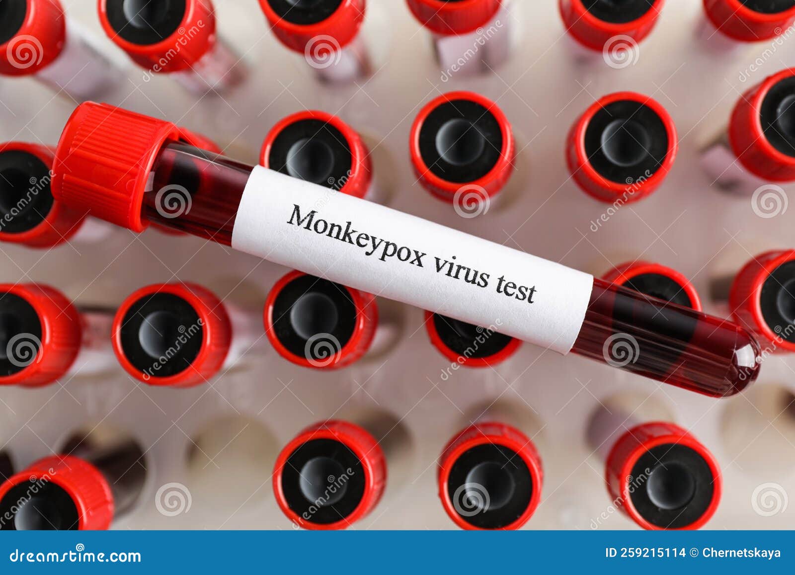 Monkeypox Virus Test. One Sample Tube with Blood on Others, Top View ...