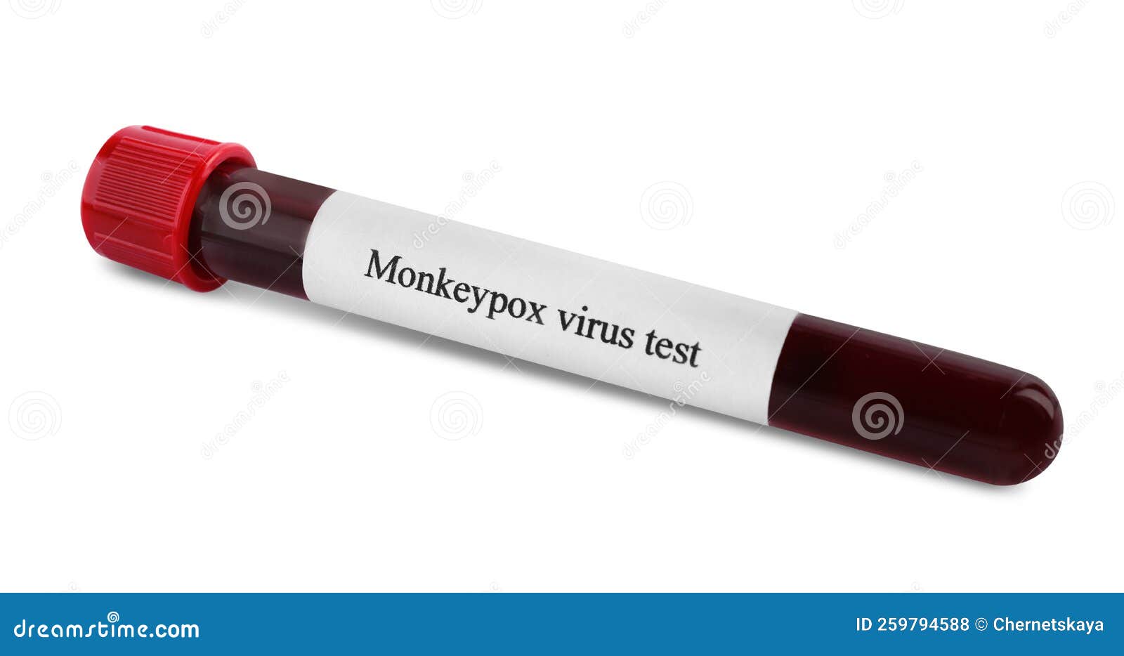 Monkeypox Virus Test. Sample Tube with Blood Isolated on White Stock ...