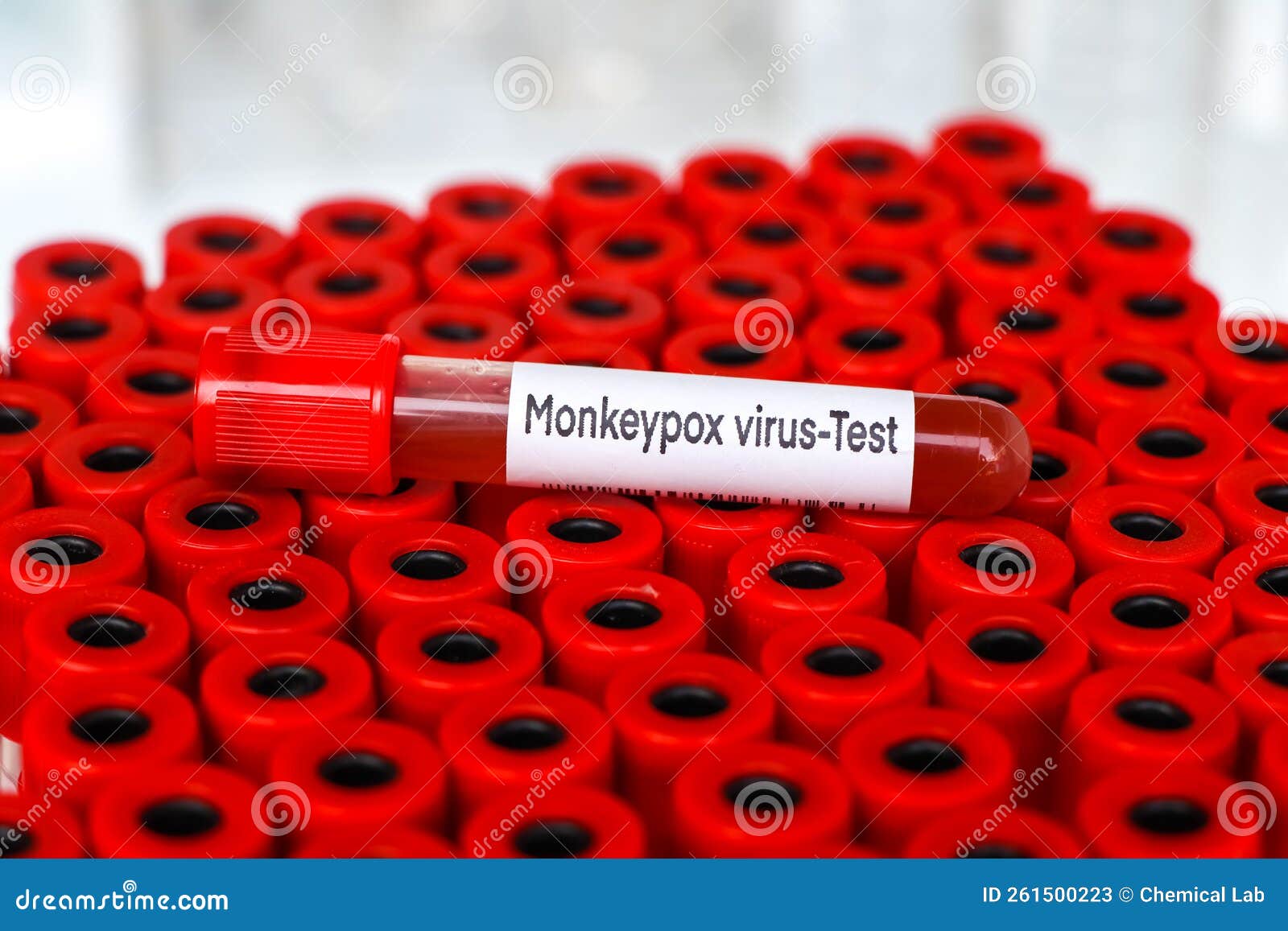Monkeypox Virus Test To Look for Abnormalities from Blood Stock Image ...