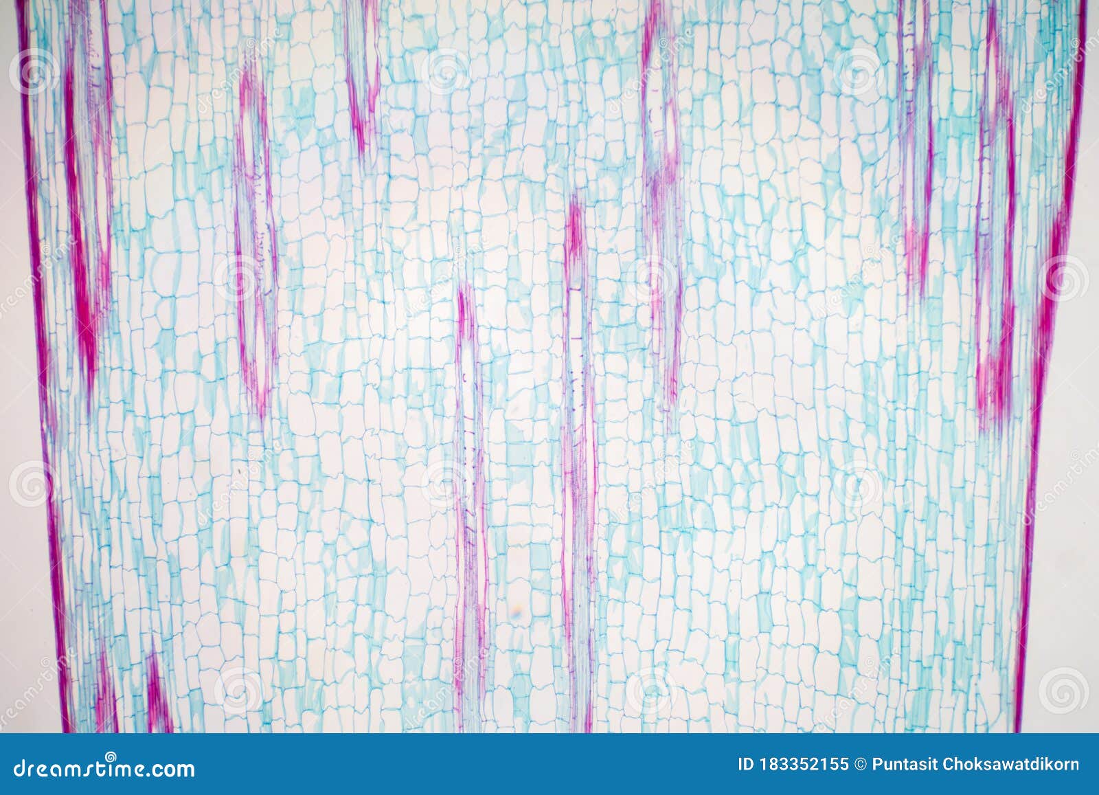 Monocot Plant Vascular Tissue Under the Microscope View Stock Image ...