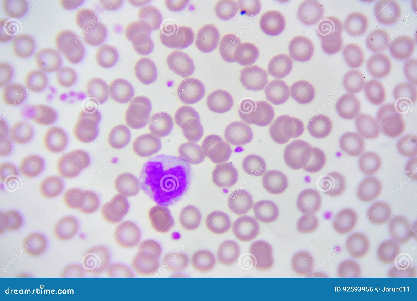 Monocyte cell stock photo. Image of leukemia, analyzing - 92593956