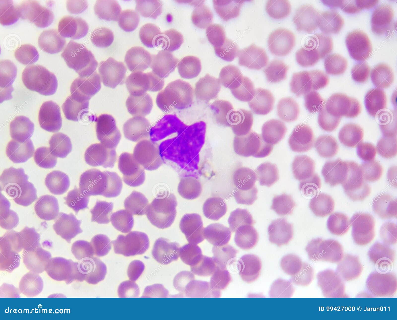 Monocyte And Lymphocyte. Red Blood Cell. Blood Smear Royalty-Free Stock ...