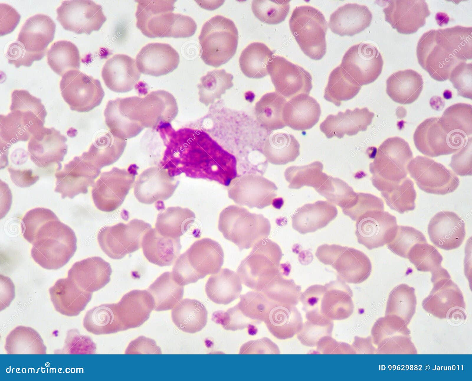 Monocyte And Lymphocyte. Red Blood Cell. Blood Smear Royalty-Free Stock ...