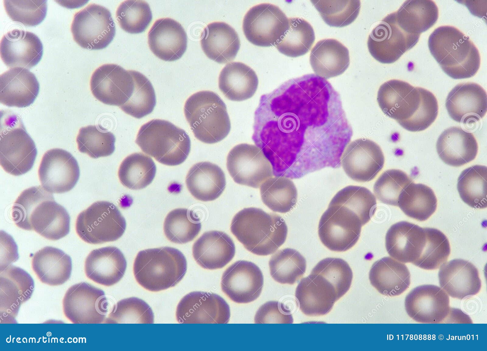 Monocyte Blood Smear