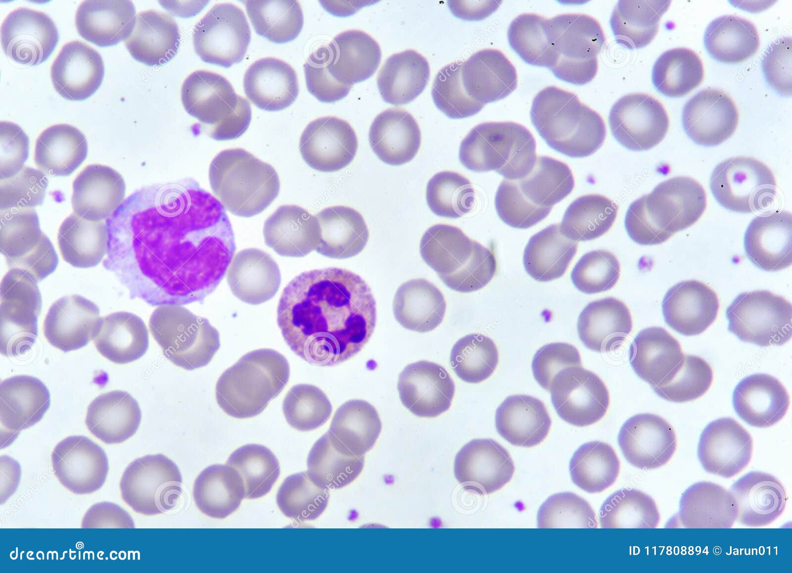 Monocyte En Neutrophil Cel in Bloedvlek Stock Foto - Image of ...