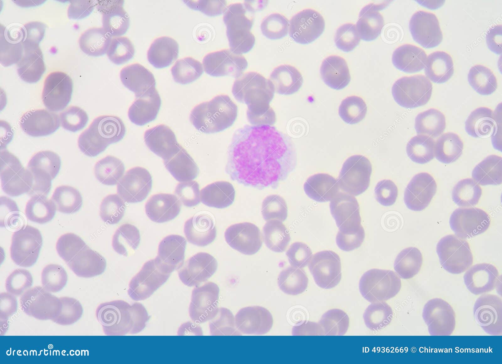 Monocyte stock image. Image of microcyte, biology, medical - 49362669