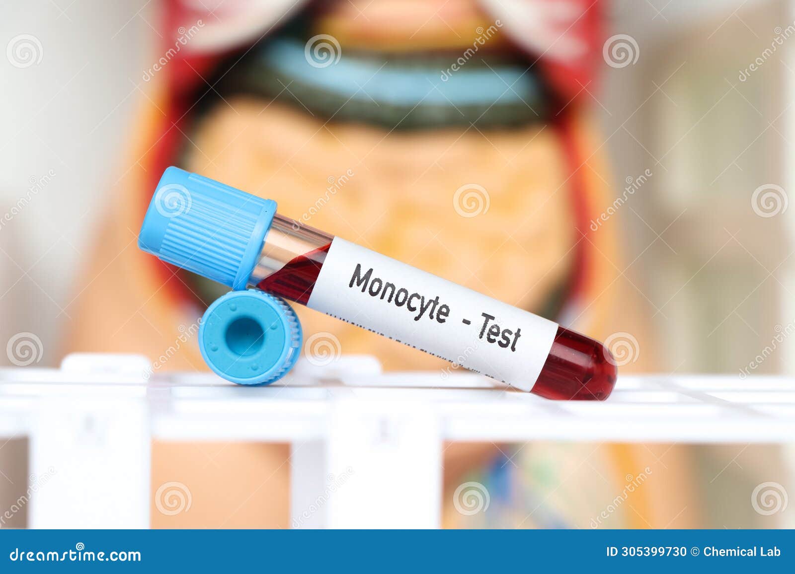 Monocyte Test, Blood Sample To Analyze in the Laboratory Stock Photo ...