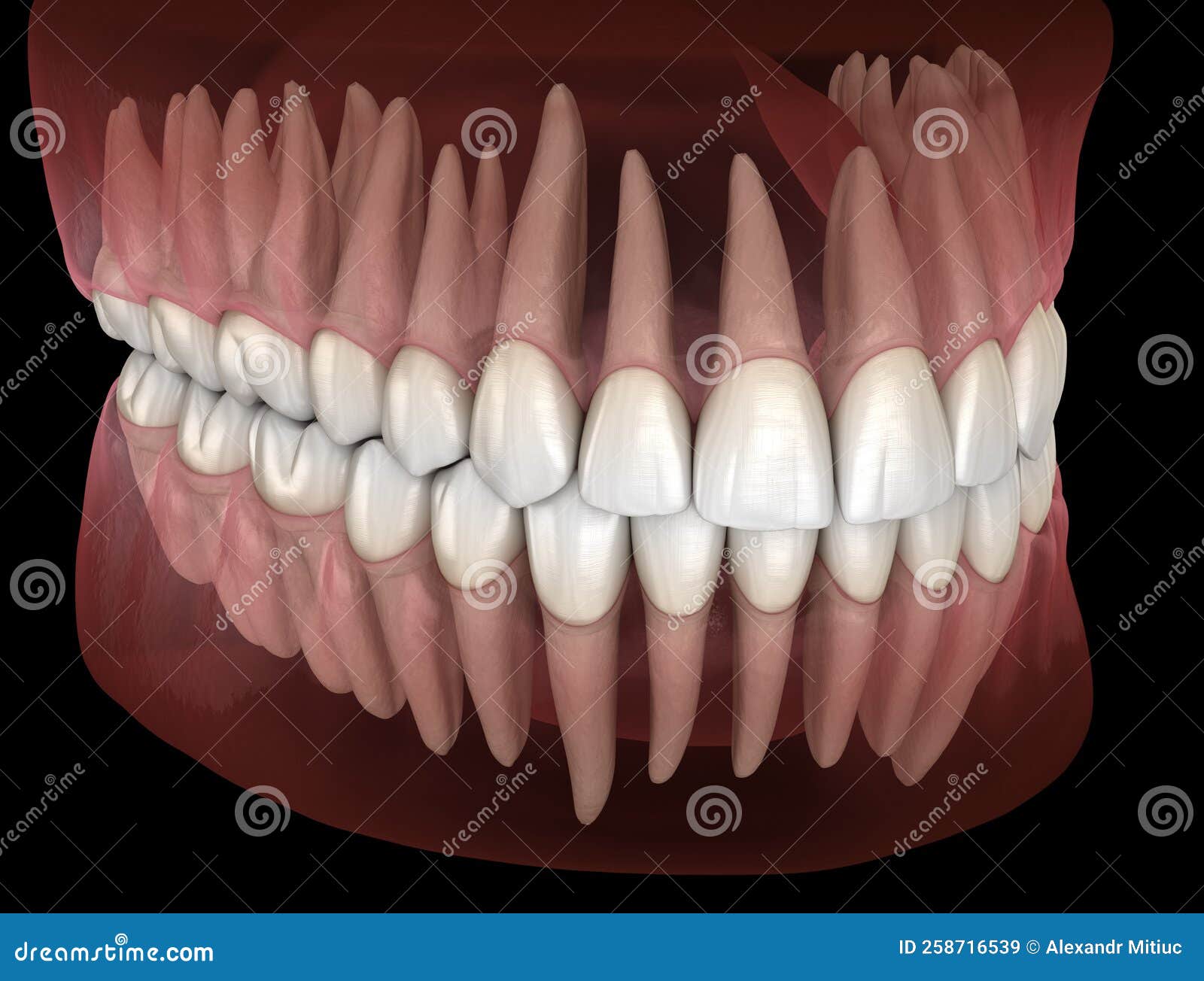 Morphology Of Human Teeth. Medically Accurate Tooth 3D Illustration ...