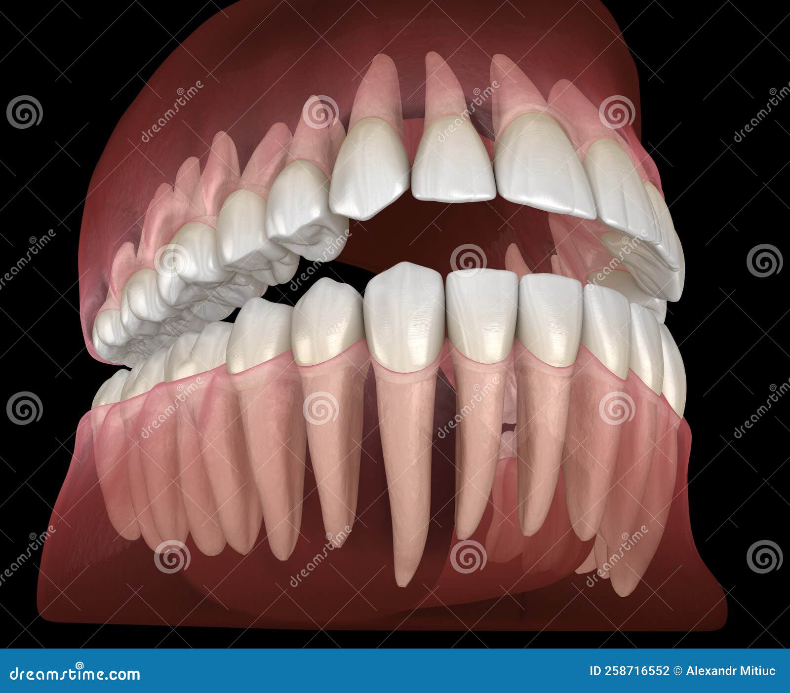 Morphology of human teeth. stock illustration. Illustration of denture ...
