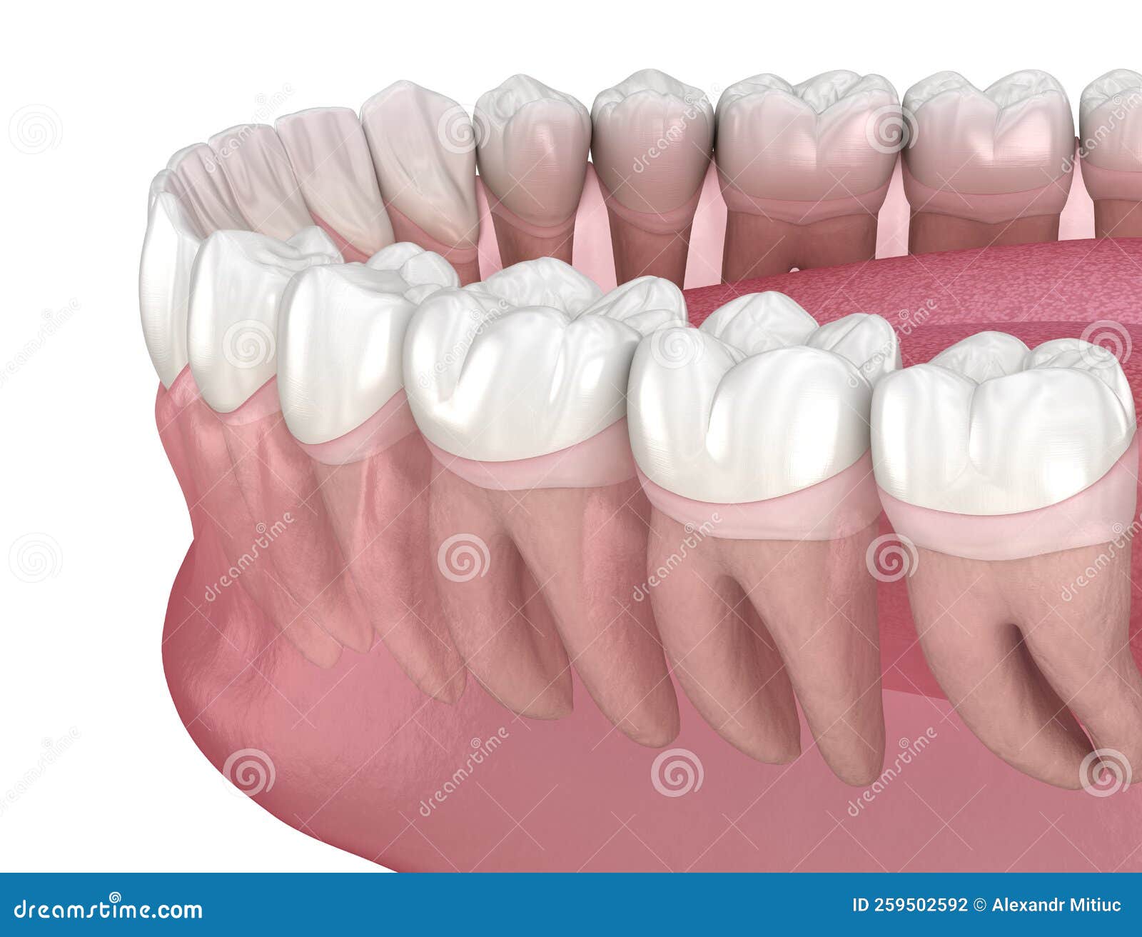 Morphology of Human Teeth. Medically Accurate Tooth 3D Illustration ...