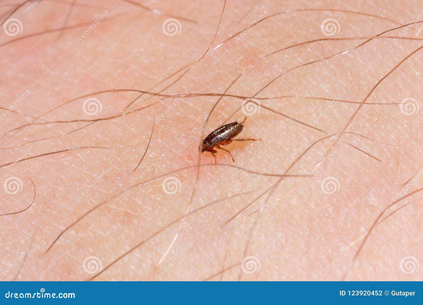 Morsi Di Pulce Su Un Essere Umano Fotografia Stock - Immagine di canis ...