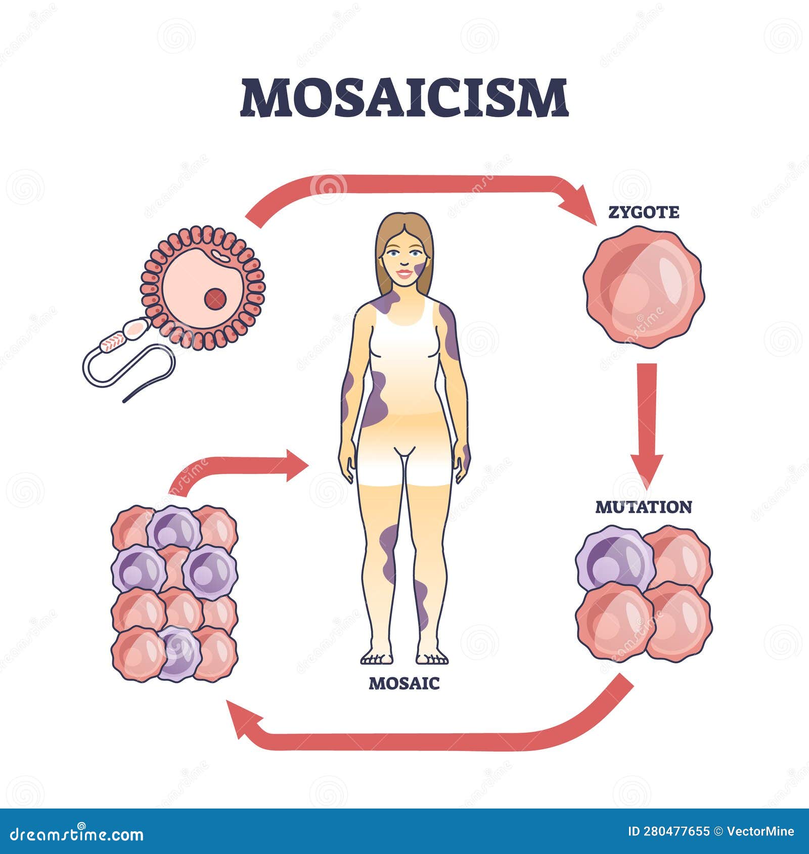 Mosaicism As Medical Genetic Condition With Cellular Defect Outline ... Mosaicism As Medical Genetic Condition With Cellular Defect Outline ...