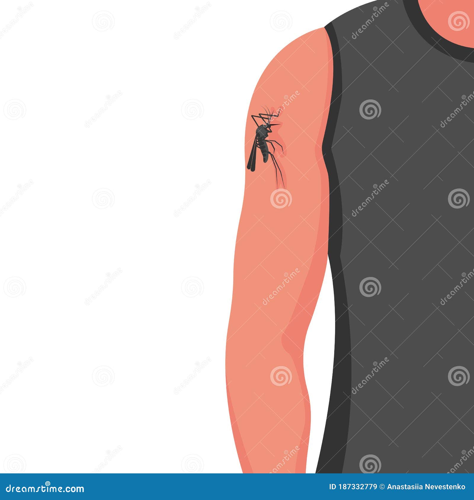 Mosquito Bite On Skin Hand Human Insect Bites Man In Arm Royalty Free Cartoon Cartoondealer