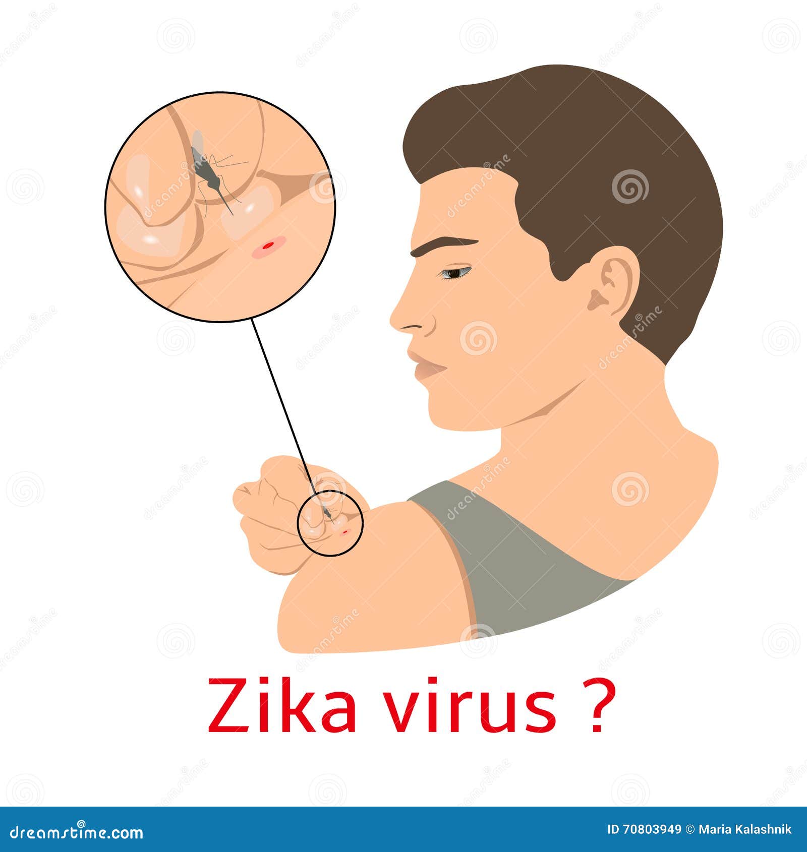 Mosquito bites man stock vector. Illustration of disease - 70803949