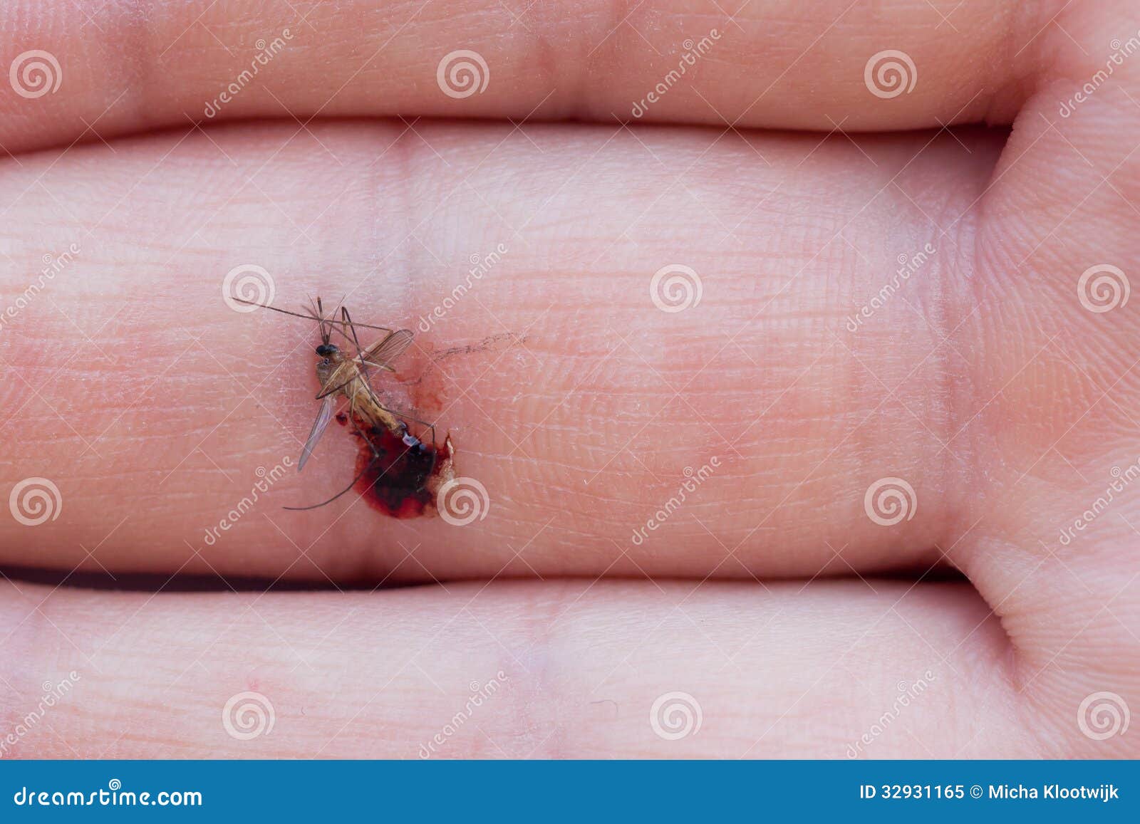 Mosquito muerto con sangre imagen de archivo. Imagen de humano - 32931165