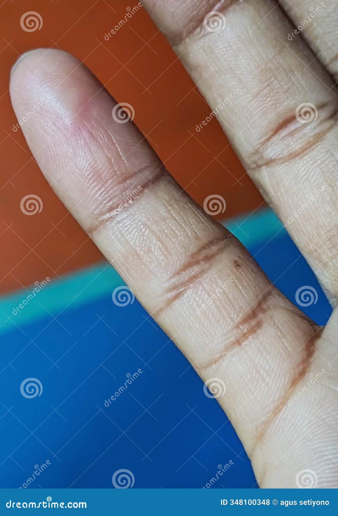 The Most Unique Little Finger in the World Has 4 Lines Stock Photo ...