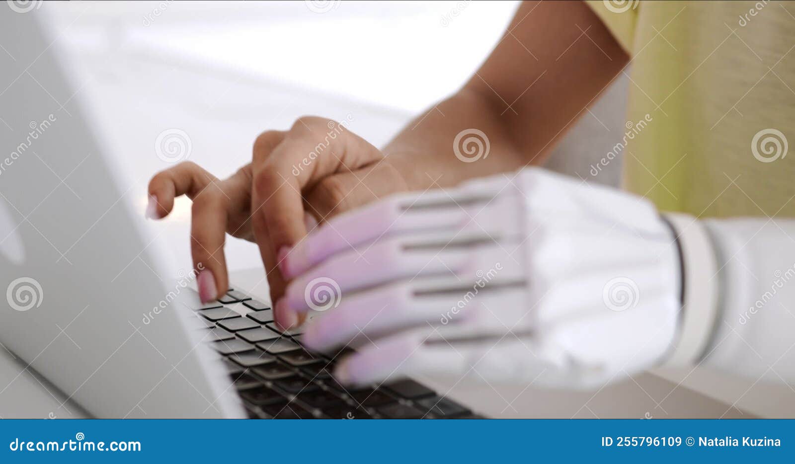 Motivated Woman Using Prosthetic Arm Working or Learning Notebook ...