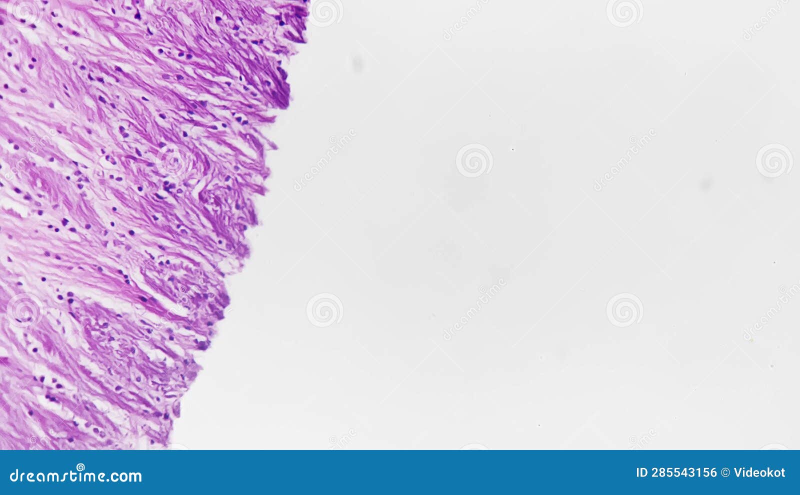 The Motor Cortex Section of a Human Being Brain is Magnified 200x Under ...