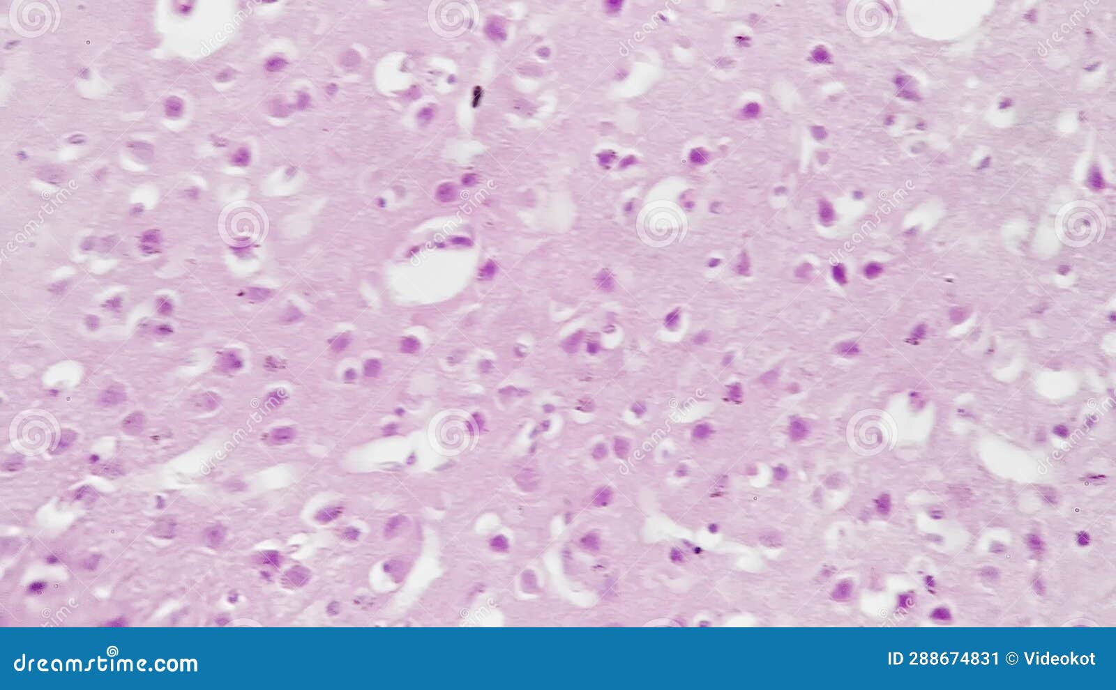 The Motor Cortex Section of a Human Being Brain is Magnified 400x Under ...