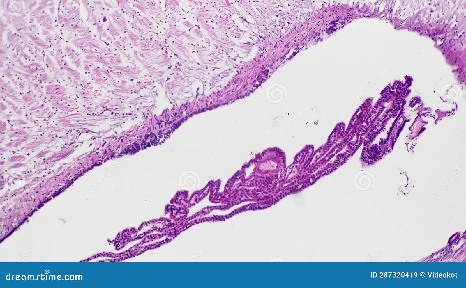 Motor Cortex Section of Human Being Magnified Under Microscope 200x on ...