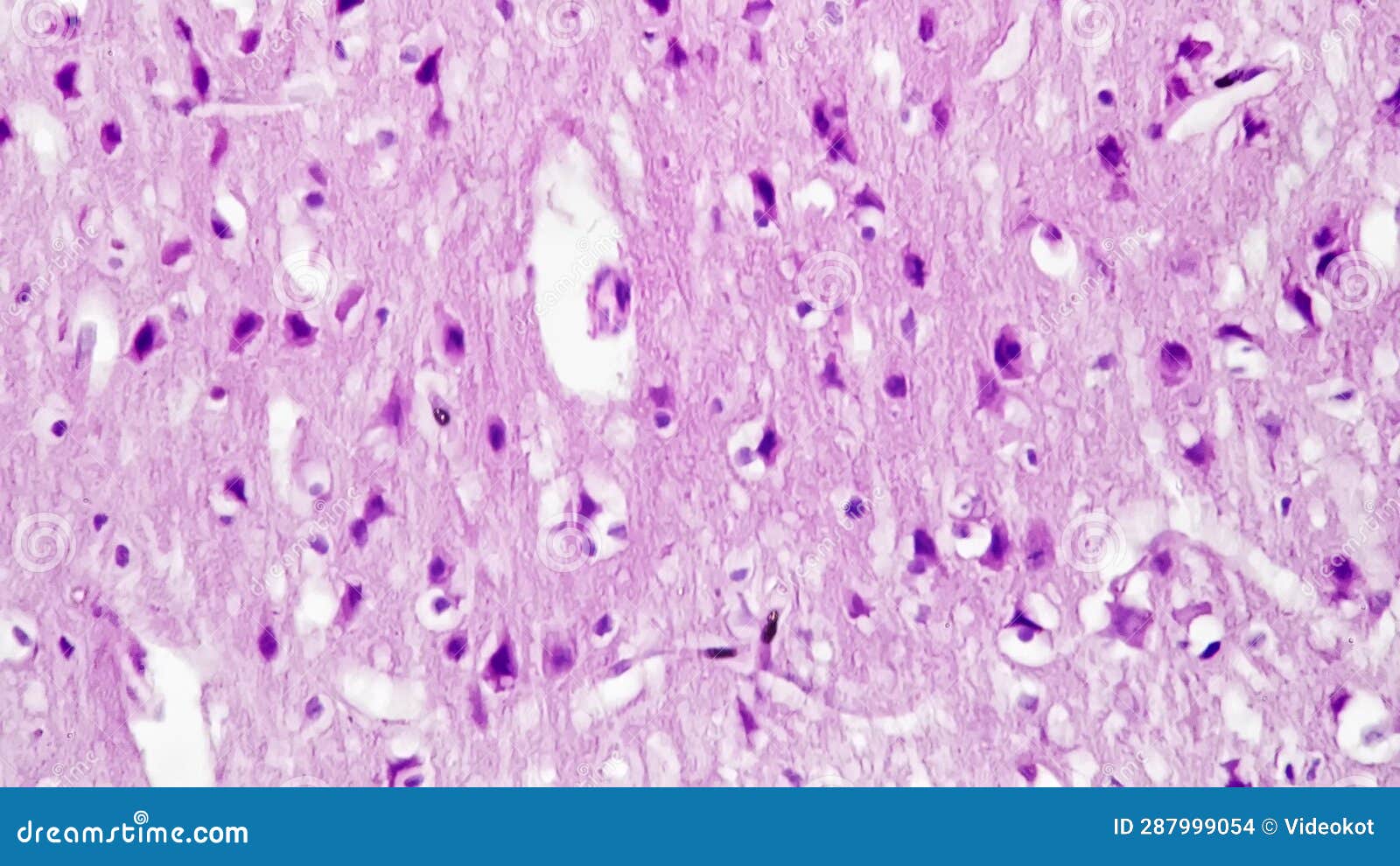 Motor Cortex Section of Human Being Magnified Under Microscope 400x on ...