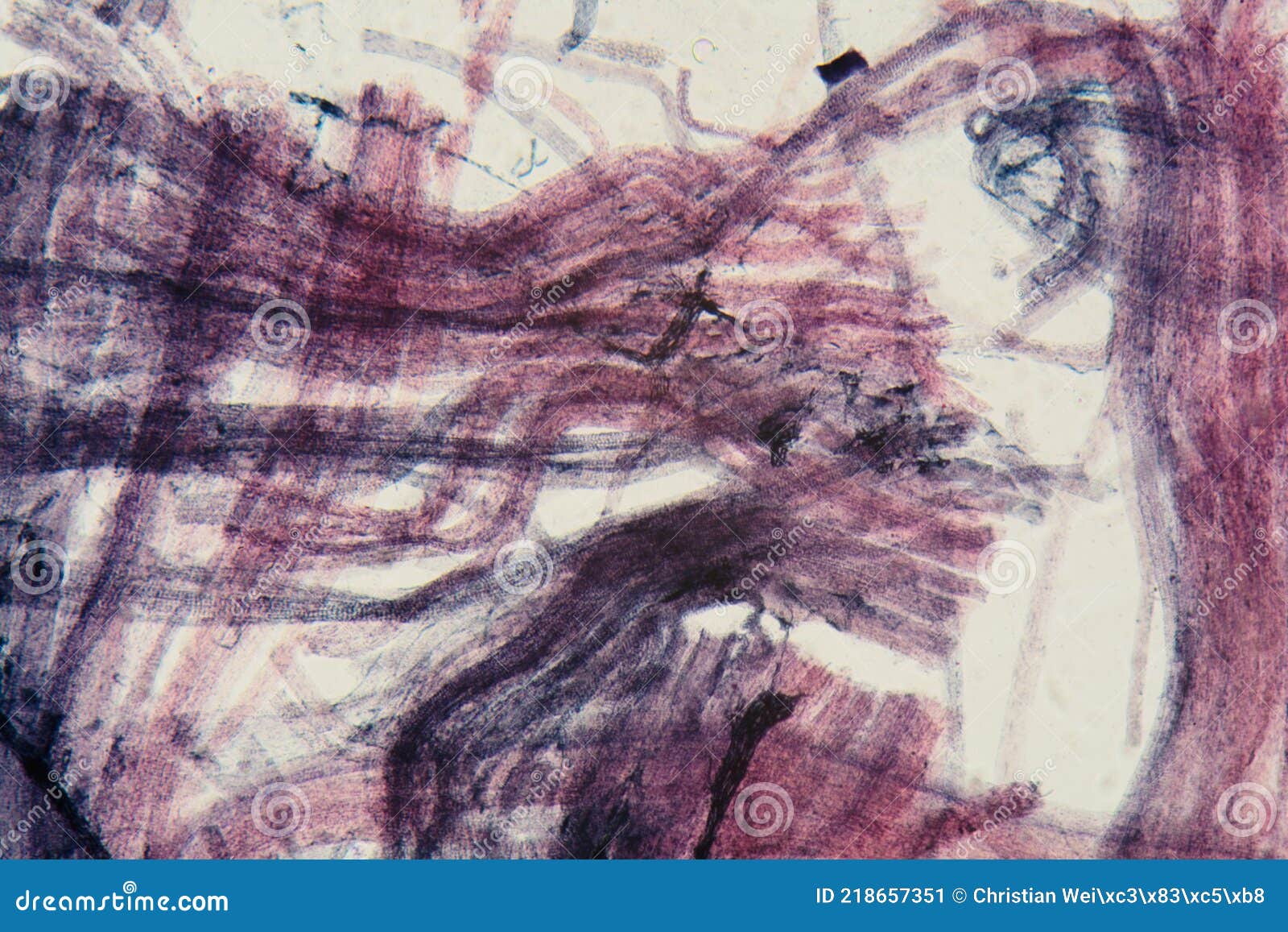 Motor Nerve Endings Under the Microscope Stock Image - Image of ...
