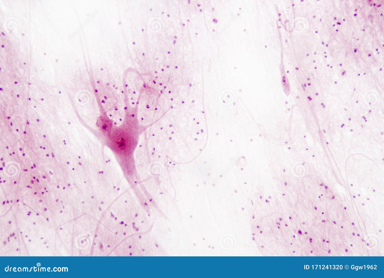 Motor Nerve stock photo. Image of enlarged, nucleus - 171241320
