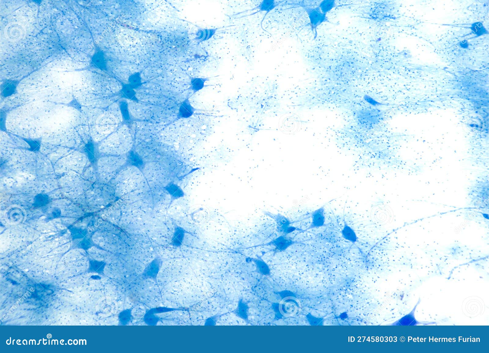 Motor Neuron Cells, Motoneurons, Whole Mount, 8X Light Micrograph Stock ...