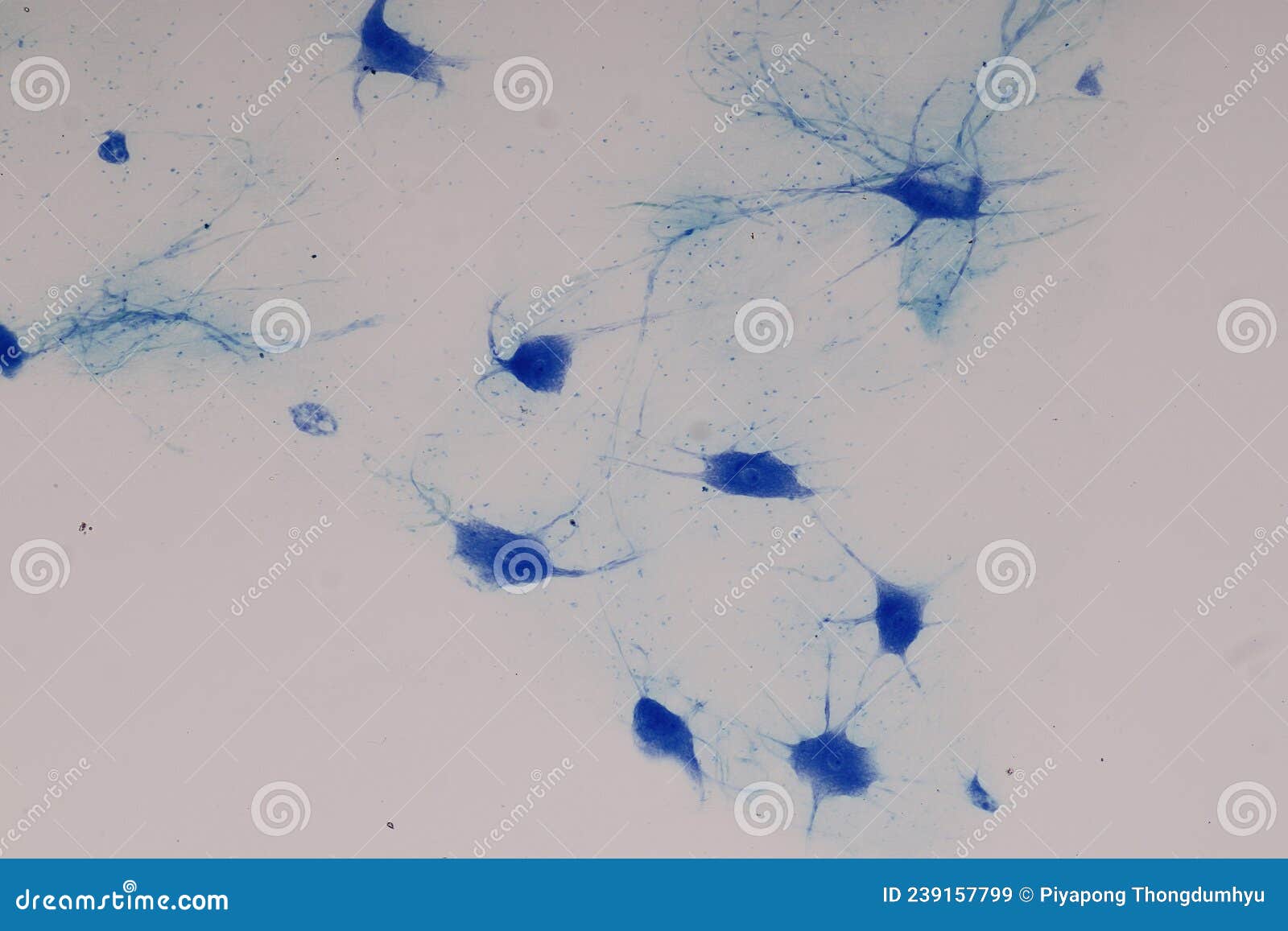 Motor Neuron and Nerve Cells Under the Microscope. Stock Image - Image ...