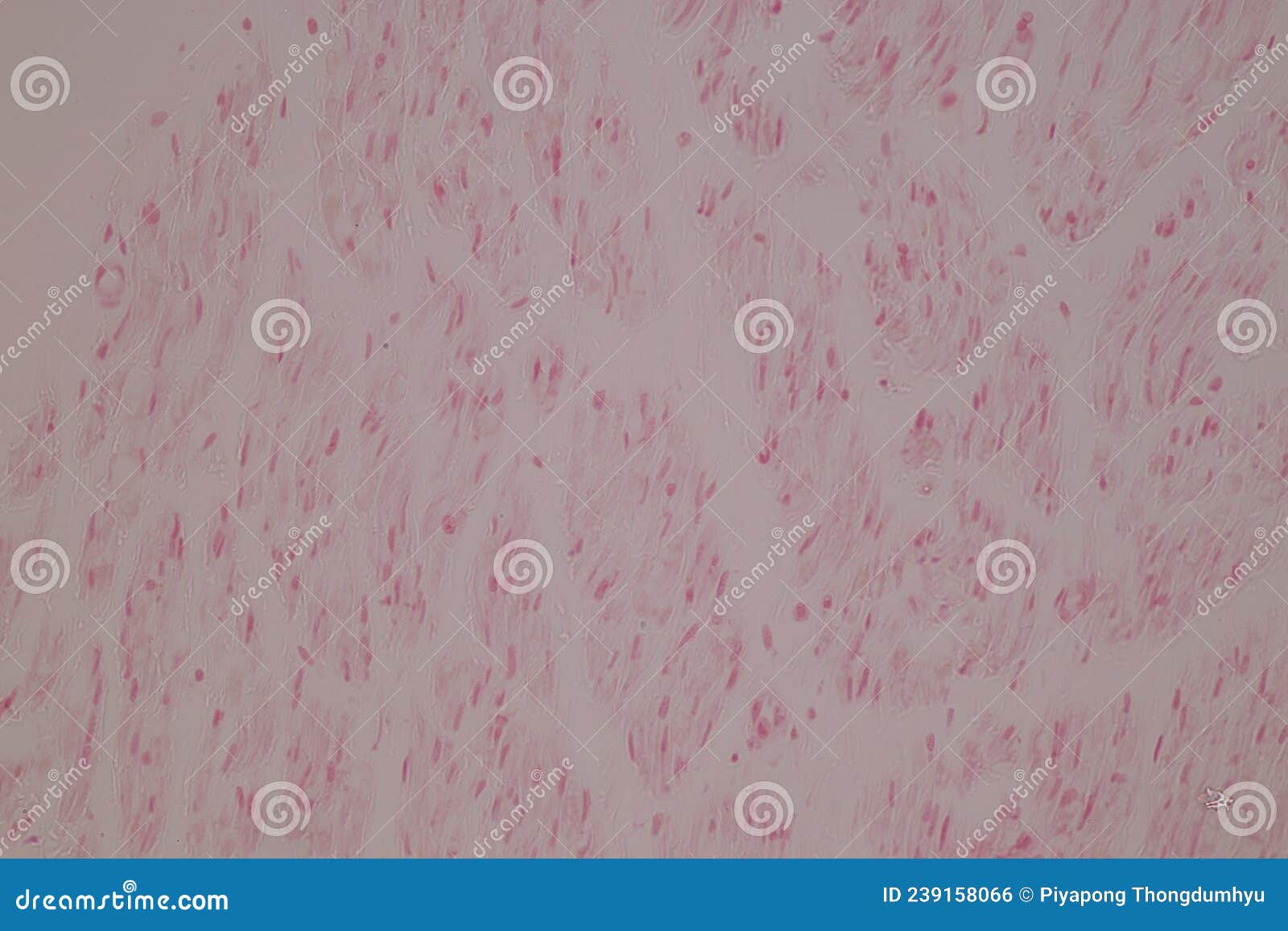 Motor Neuron and Nerve Cells Under the Microscope. Stock Photo - Image ...