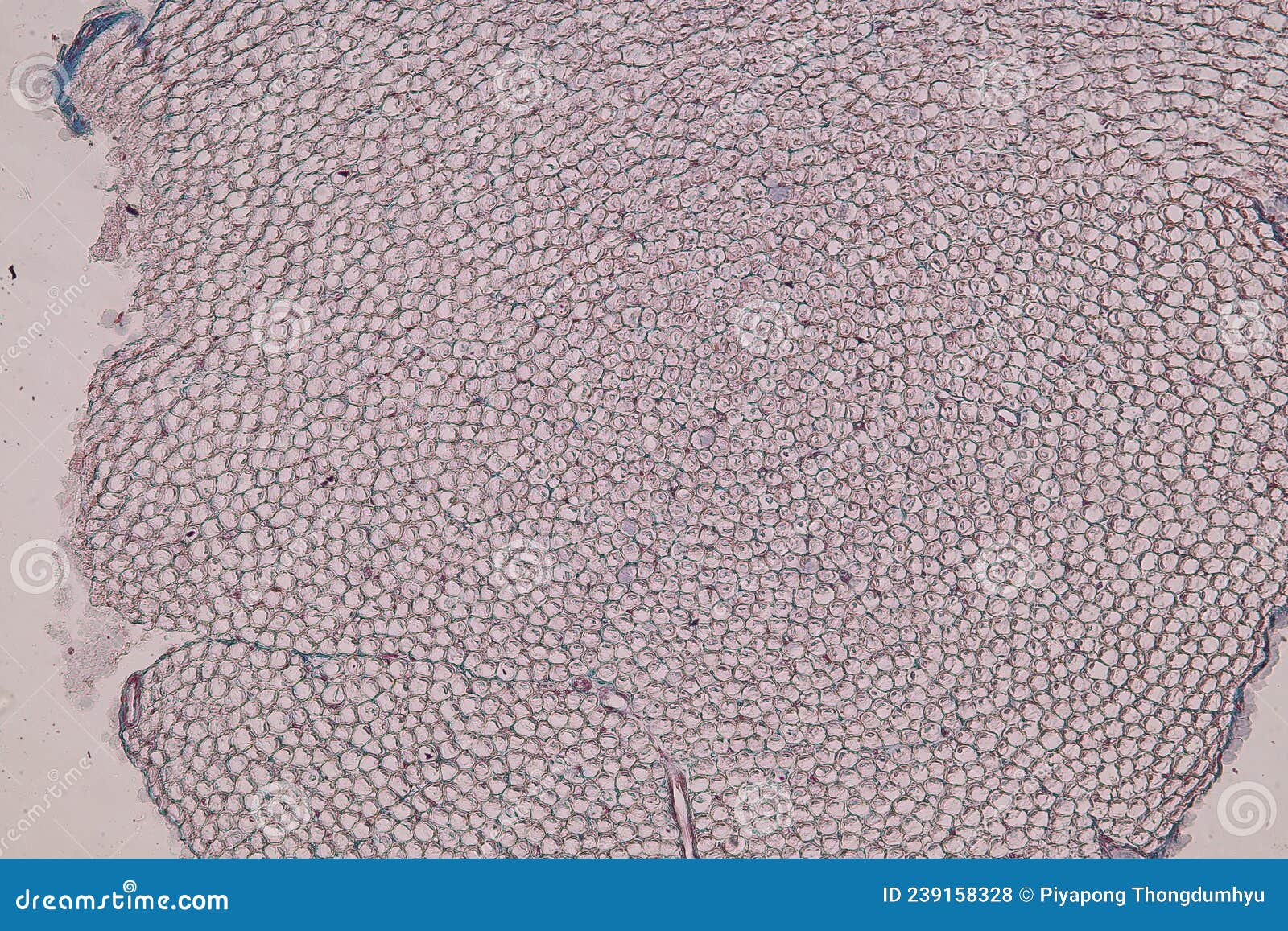 Motor Neuron and Nerve Cells Under the Microscope. Stock Photo - Image ...