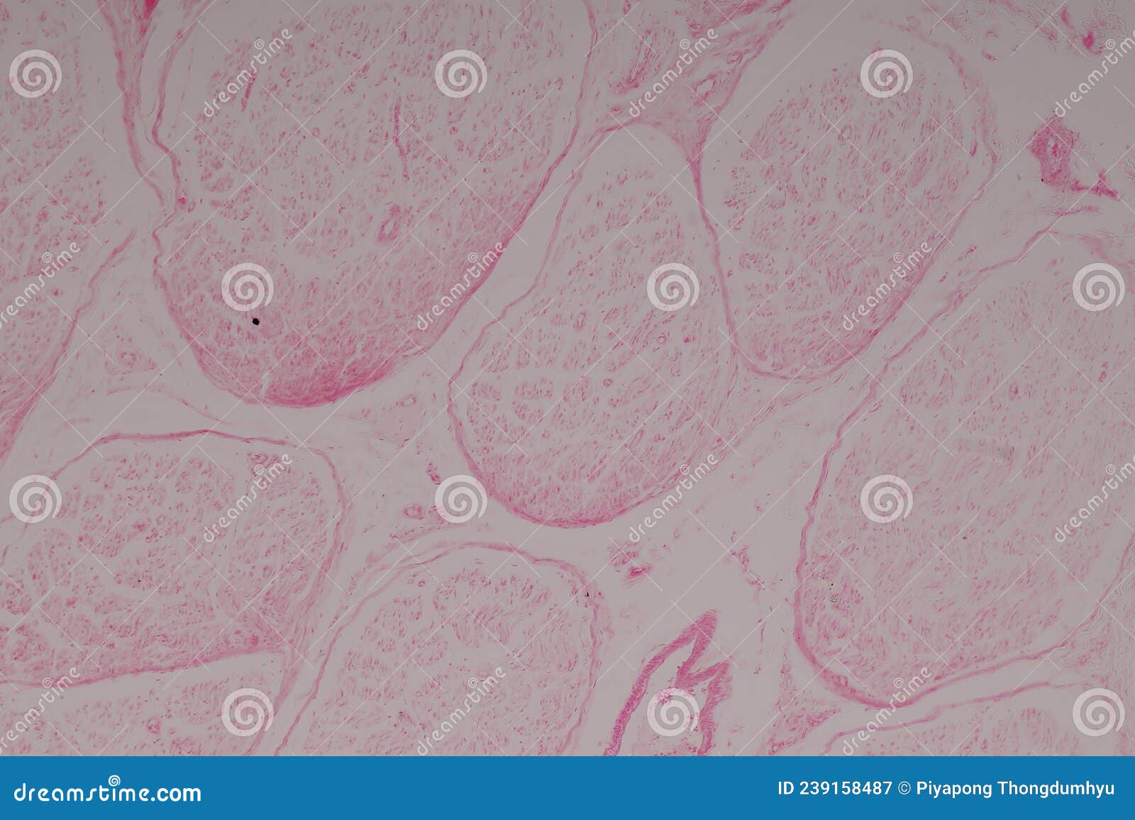 Motor Neuron and Nerve Cells Under the Microscope. Stock Image - Image ...