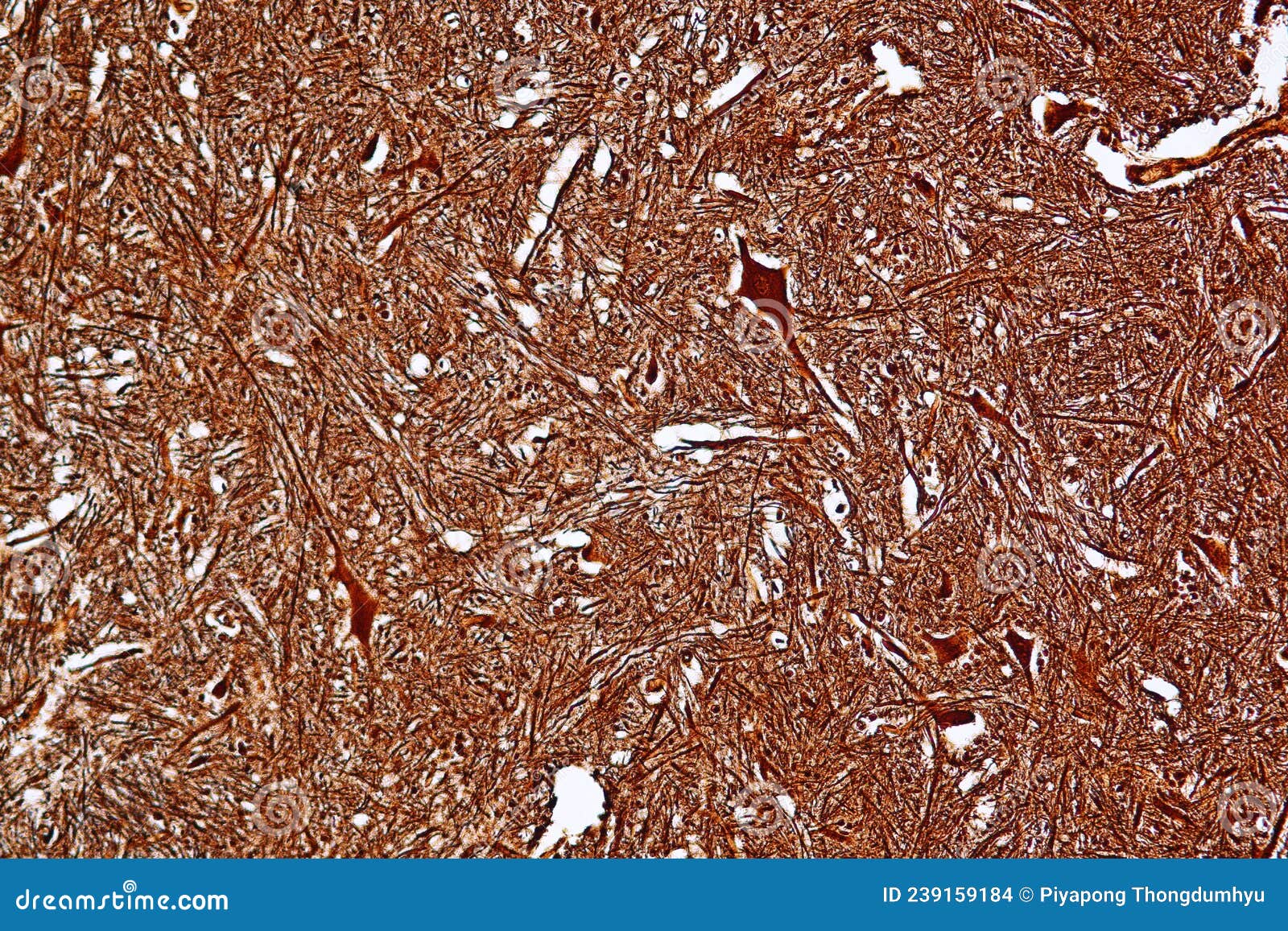 Motor Neuron and Nerve Cells Under the Microscope. Stock Photo - Image ...