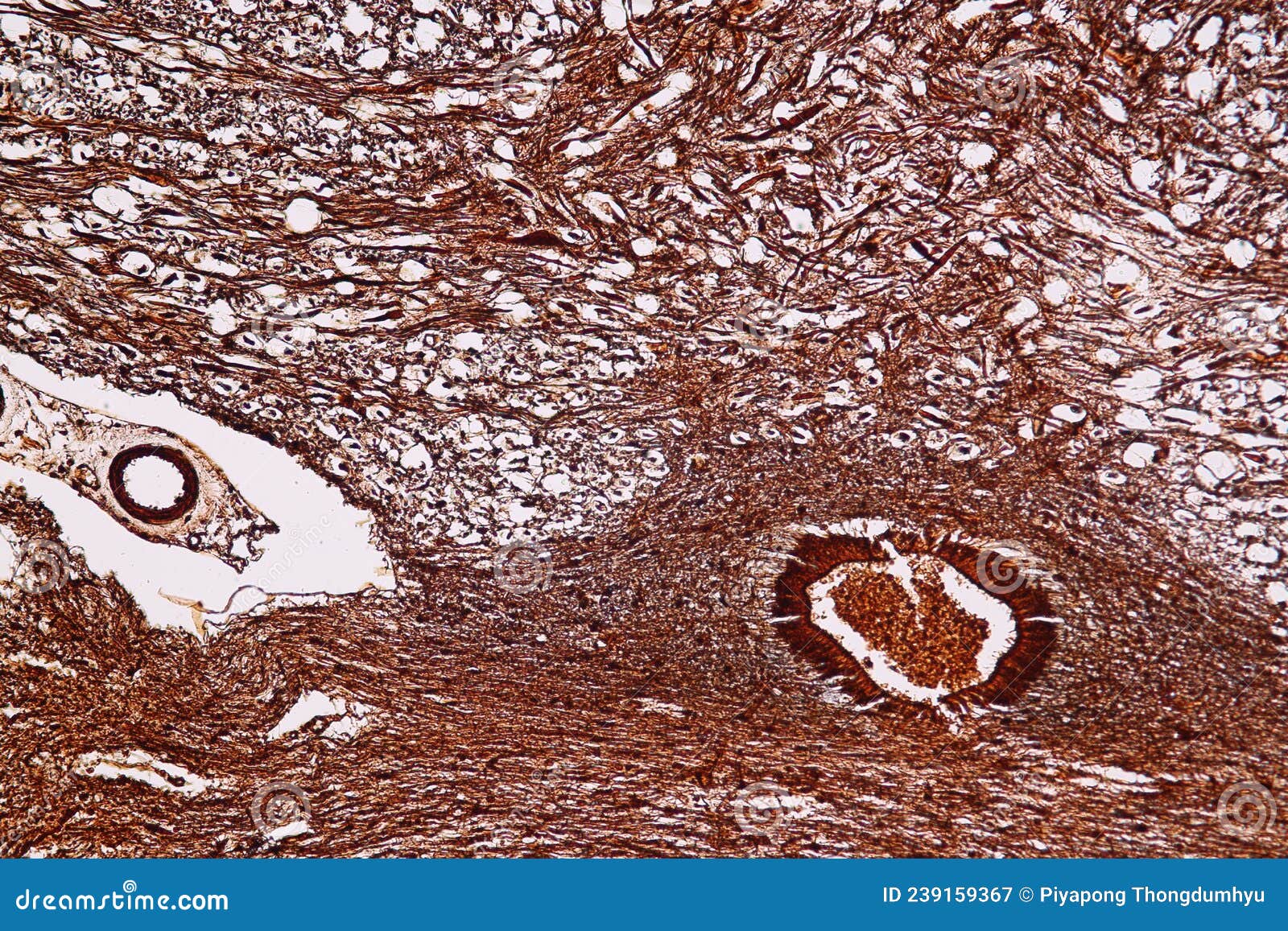 Motor Neuron and Nerve Cells Under the Microscope. Stock Image - Image ...