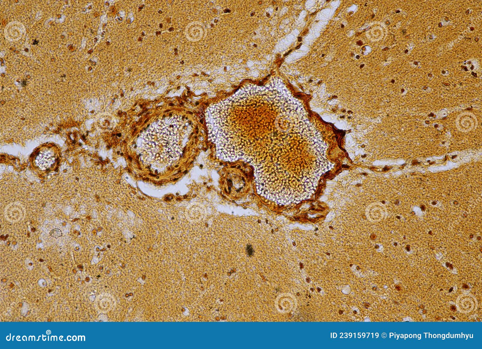 Motor Neuron and Nerve Cells Under the Microscope. Stock Image - Image ...