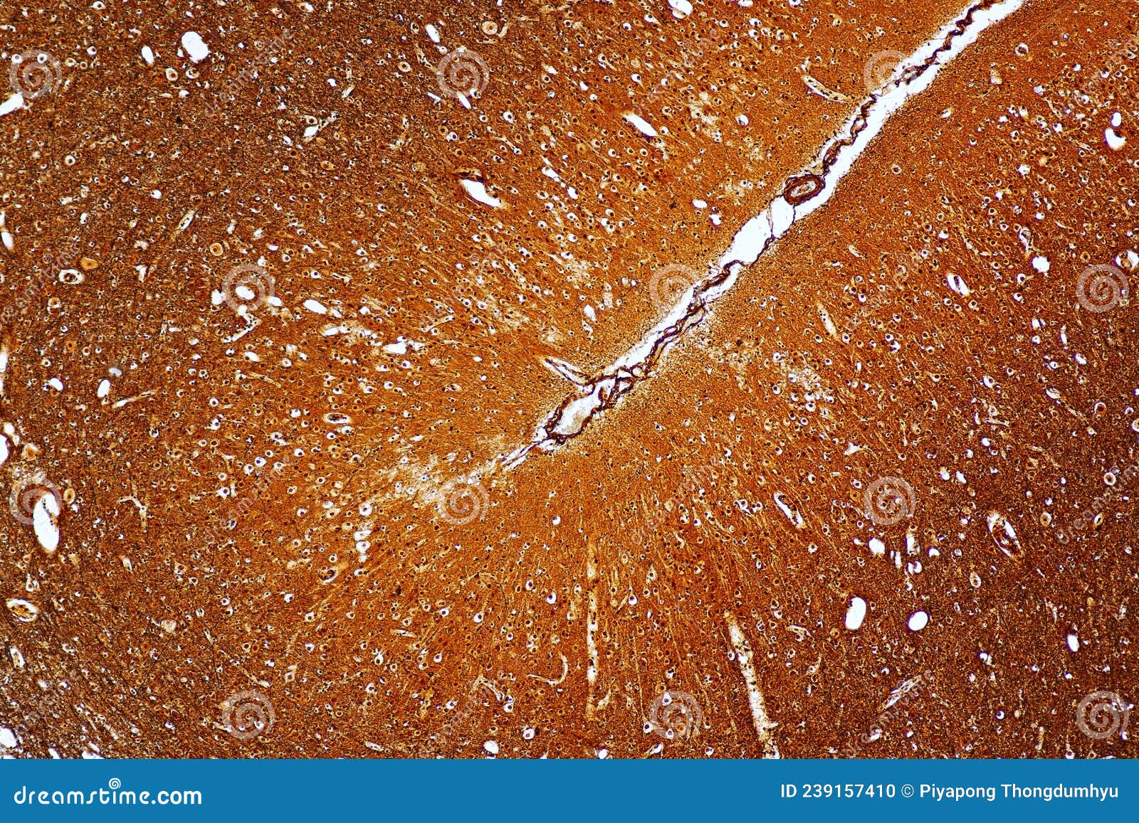 Motor Neuron and Nerve Cells Under the Microscope. Stock Photo - Image ...