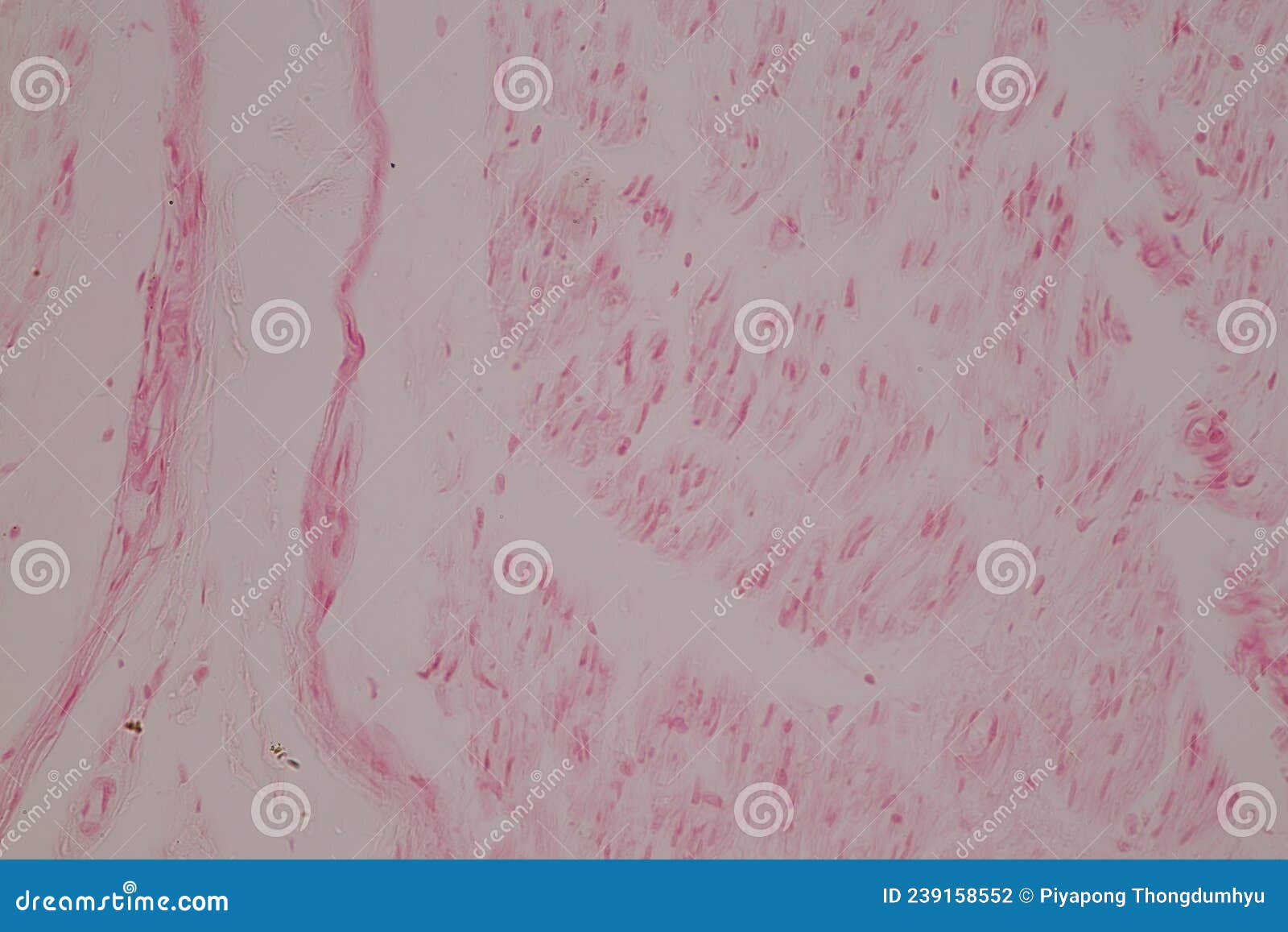 Motor Neuron and Nerve Cells Under the Microscope. Stock Photo - Image ...