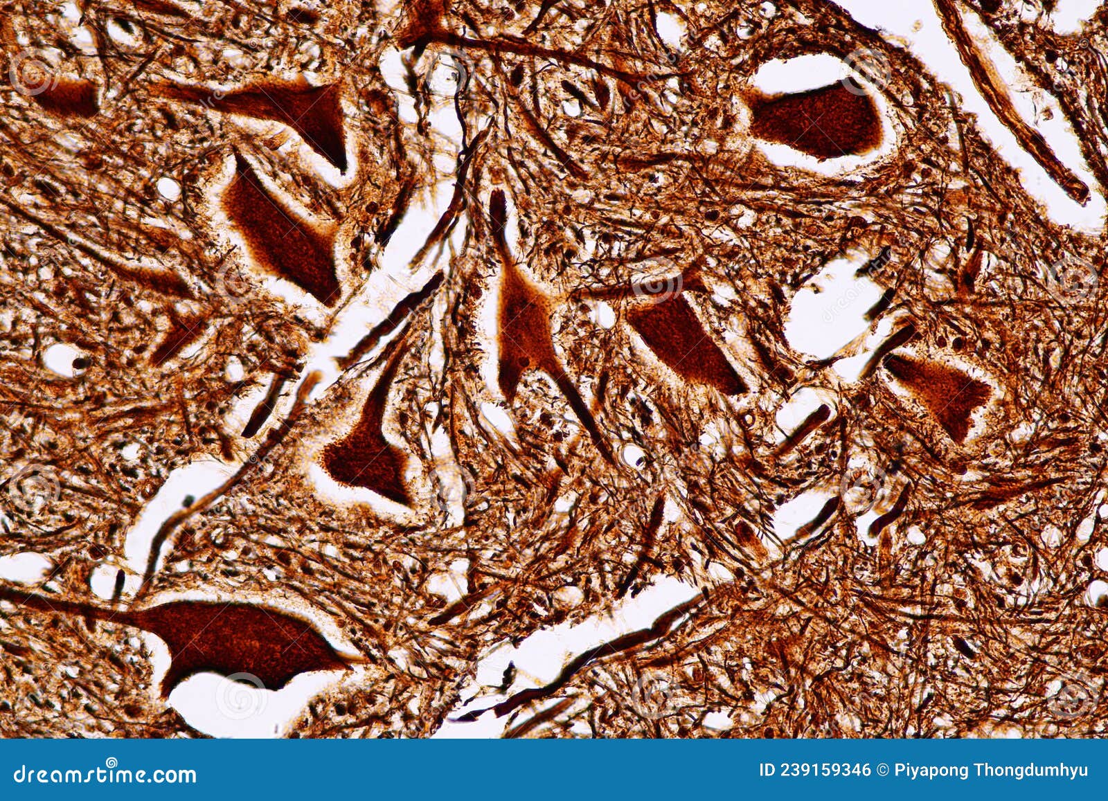 Motor Neuron and Nerve Cells Under the Microscope. Stock Photo - Image ...