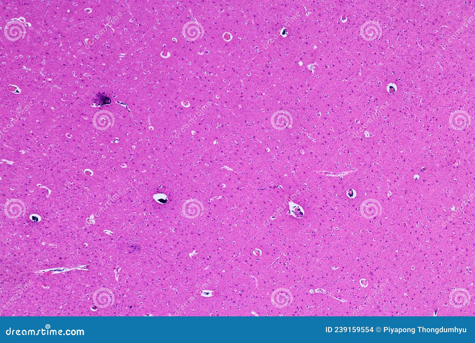 Motor Neuron and Nerve Cells Under the Microscope. Stock Photo - Image ...