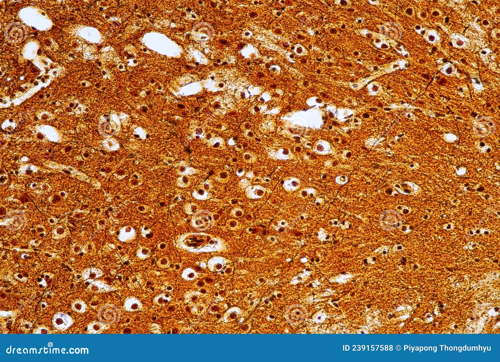 Motor Neuron and Nerve Cells Under the Microscope. Stock Photo - Image ...