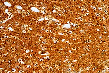 Motor Neuron and Nerve Cells Under the Microscope. Stock Photo - Image ...