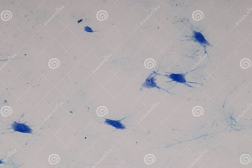 Motor Neuron and Nerve Cells Under the Microscope. Stock Image - Image ...