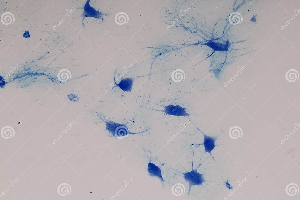 Motor Neuron and Nerve Cells Under the Microscope. Stock Image - Image ...