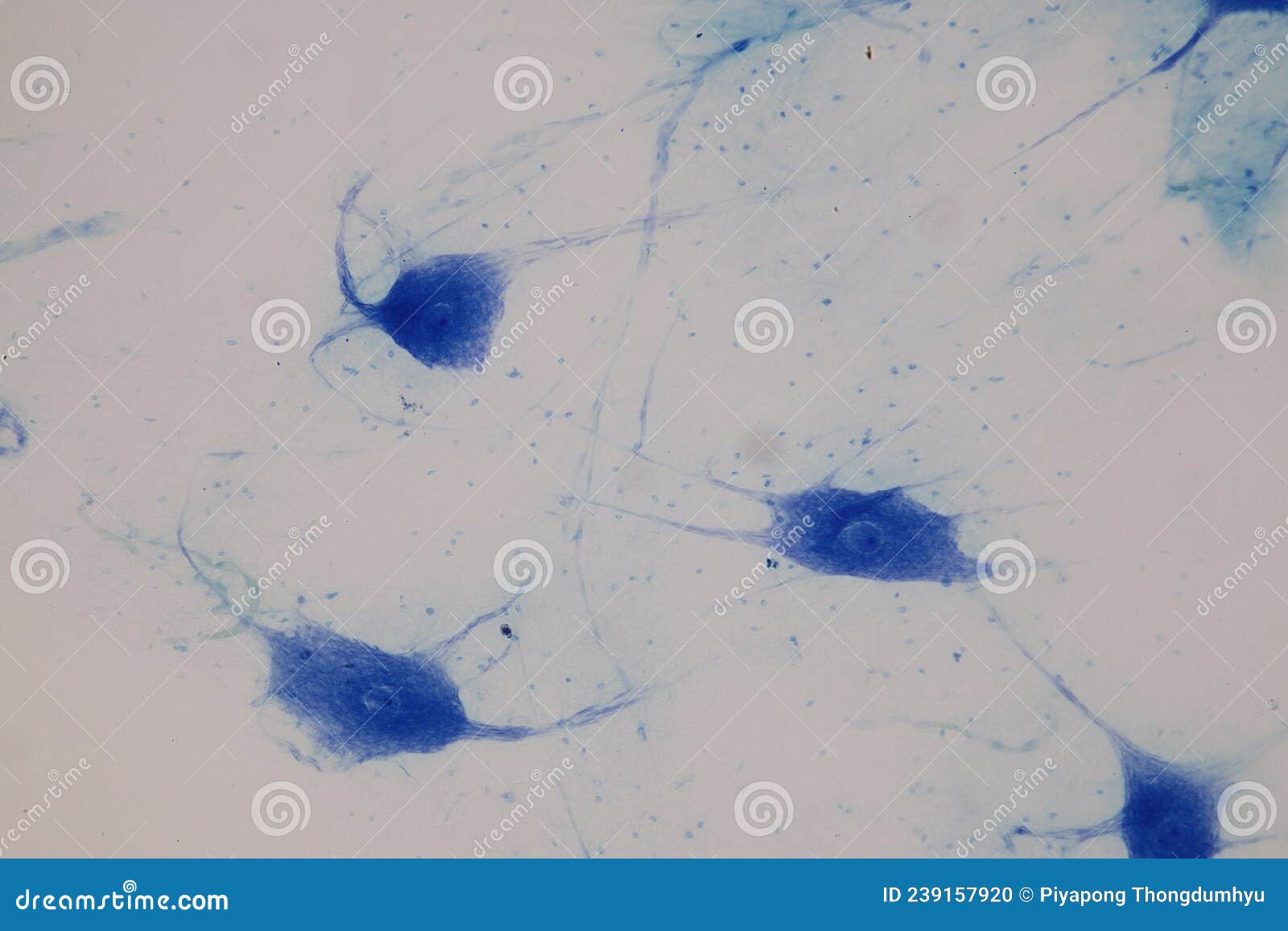 Motor Neuron and Nerve Cells Under the Microscope. Stock Photo - Image ...