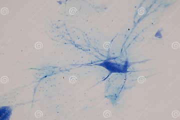 Motor Neuron and Nerve Cells Under the Microscope. Stock Image - Image ...